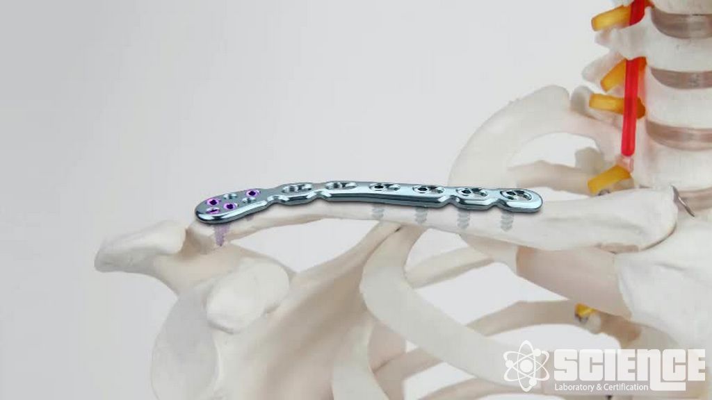 Bone Plate, Bone Screw, and Fixing Device Test